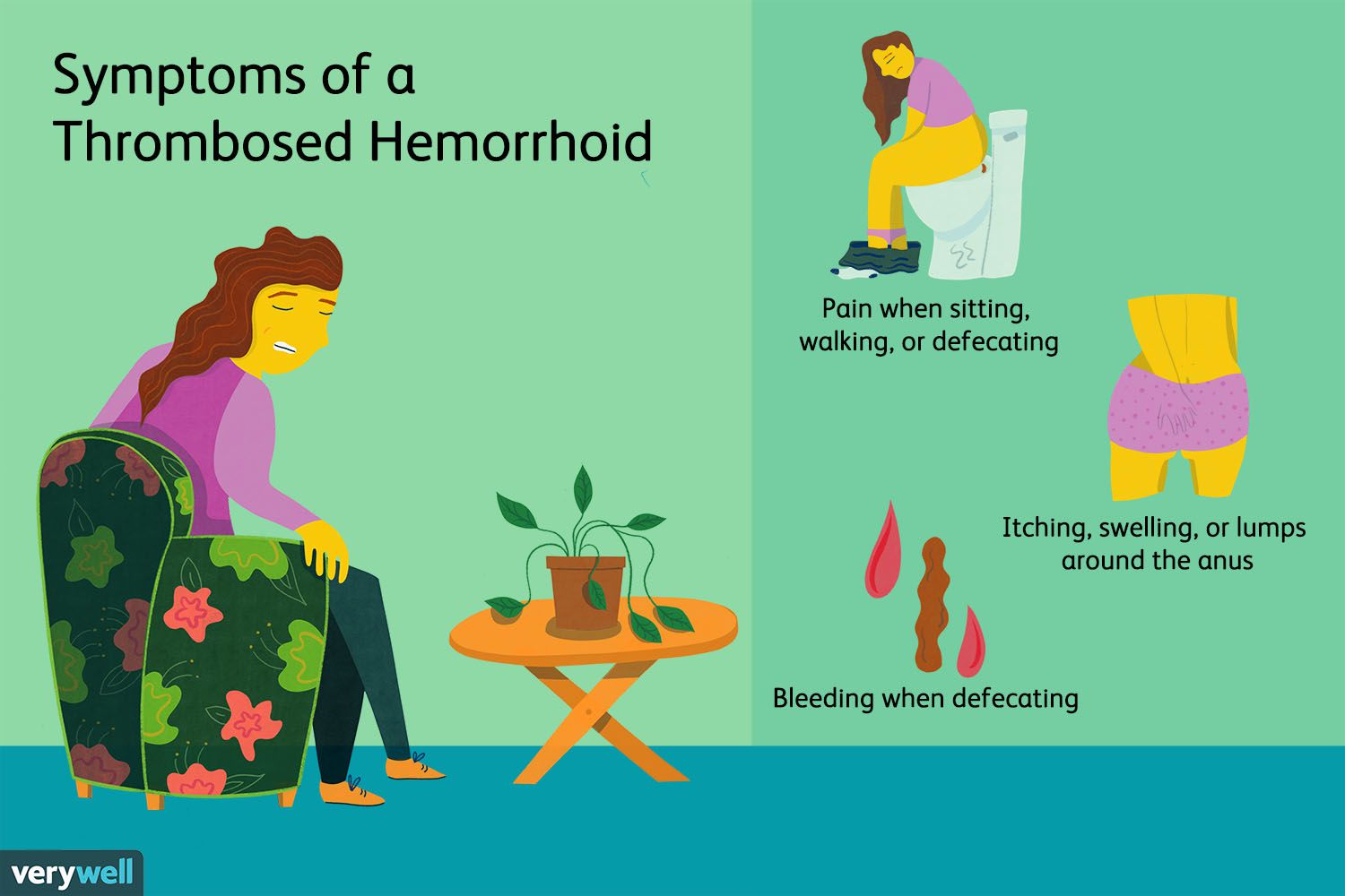 Thrombosed Hemorrhoid: Understanding, Treatment, and Prevention