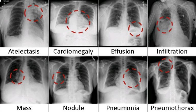 Twilight Anesthesia | What makes it different ? | Medicogenic