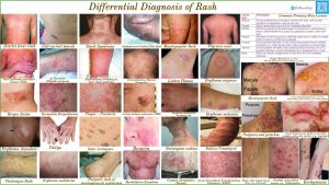 NBME Practice Exams For Free | Take a real NBME exam online