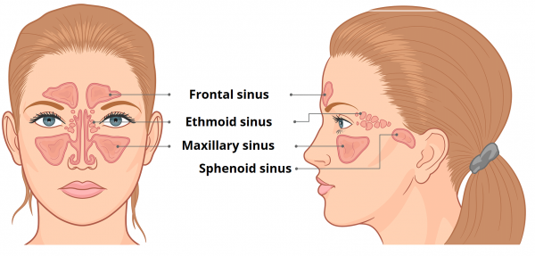 Ethmoidal polyp | Causes, Symptoms, Treatment options